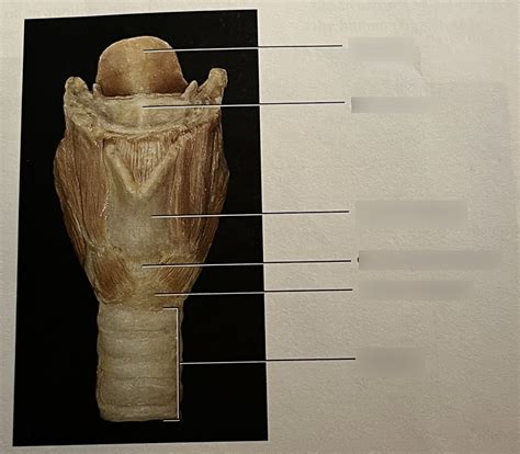 Cricothyroid Cadaver Anatomical Variations Of The Recurrent Laryngeal