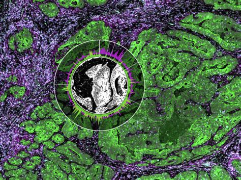 Nanostring Geomx Services Spatial Transcriptomics