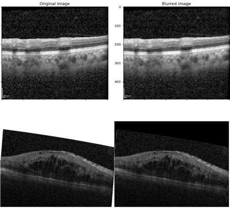 論文レビュー Ophthalmic Biomarker Detection With Parallel Prediction Of