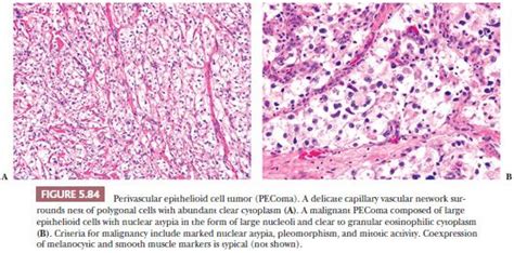 Soft Tissues Basicmedical Key