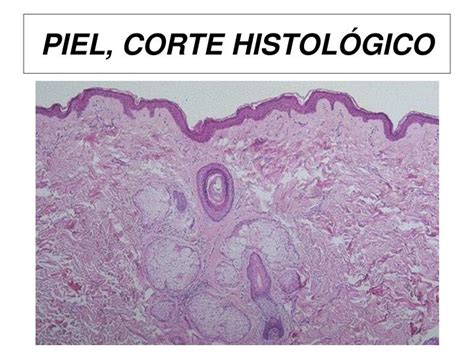 Ppt HistologÍa De La Piel Powerpoint Presentation Id 5792739