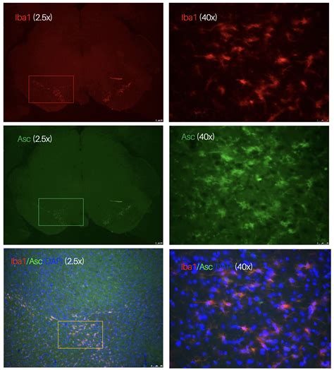 Mptp Mouse Model Of Parkinsons Disease Neurology Cro Innoser