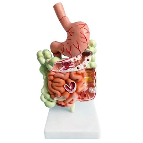 Buy Vklopdsh Human Digestive System Model Stomach Anatomy Intestine Cecum Rectum Duodenum Human