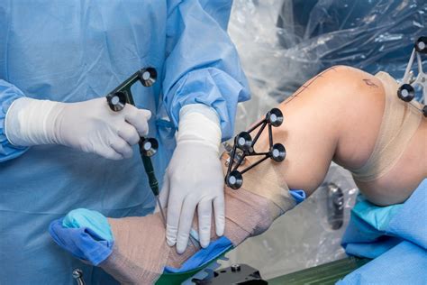 Why Mako Robotic Knee Replacement Might Be Right For You Thestreethearts