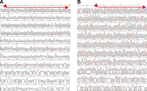 A The Orientation Sequence Of Recombinant Plasmid Download Scientific Diagram