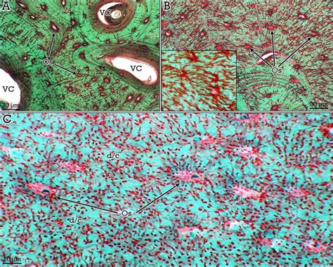 Rgb Trichrome Staining Of Compact Bone Osteocytes Os Are Arranged