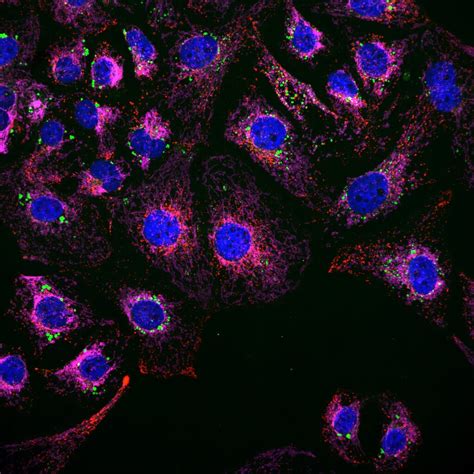 Automatically Identify Cell Boundary Based On Several Fluorescent