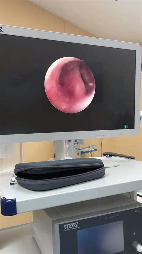 Dr Parisaa Obgyn Rei On Twitter Multiple Polyps In A 70 Year Old Menopausal Woman Without