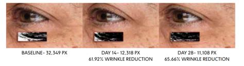 Tagra Biotech Cellucap C Ascorbyl Tetraisopalmitate Vitamin C