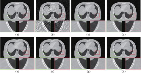 Figure 1 From Robust Low Dose Ct Sinogram Preprocessing Via Exploiting Noise Generating