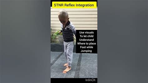 Brain Boosting Activity Stnr Integration Improve Symmetrical Movement