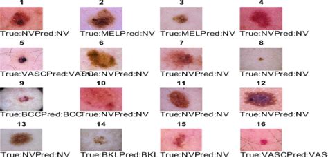 Predictions On Random Samples Made By Transfer Learning On Mobilenetv2