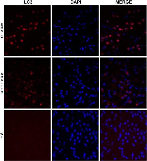 Immunofluorescence Staining For Lc3 On Spinal Cord Tissue Under Ttc