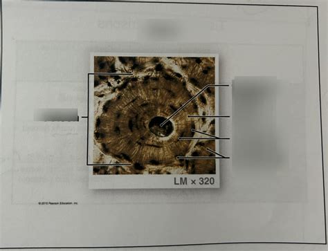 Bone Diagram Quizlet Bone Diagram Quizlet