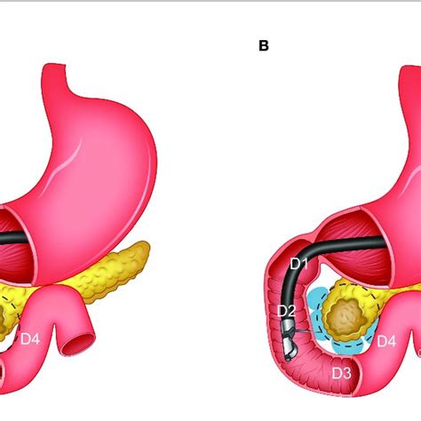 An Illustration Of The Pancreas And Different Sections Of The Download Scientific Diagram