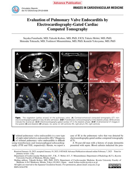 Pdf Evaluation Of Pulmonary Valve Endocarditis By Electrocardiography