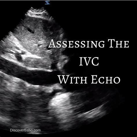 Ivc Assessment With Echo What Does Ivc Collapse Even Mean
