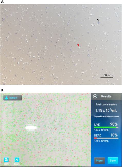 Examination Of Cell Viability By Countess Ii And Microscope A