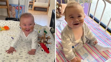 My Sons Umbilical Cord Fell Off Two Weeks After Birth That Was The