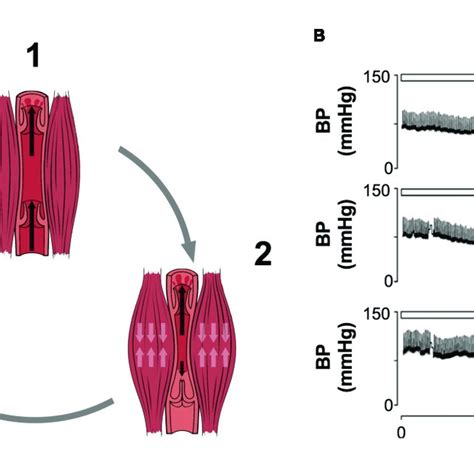 Pdf Counter Pressure Maneuvers For Syncope Prevention A Semi