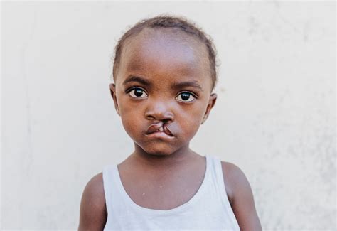 Kärlek Gjorde Skillnad Armanes Berättelse Mercy Ships Sverige