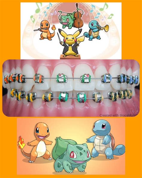 Pokemon Braces Colors Endoprepapp