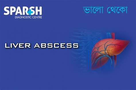 Liver Abscess Causes Symptoms Diagnosis Treatment And Prevention Sparsh Diagnostic Center