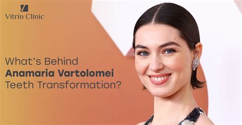 Por Qué La Transformación Dental De Anamaria Vartolomei Sorprende A Los