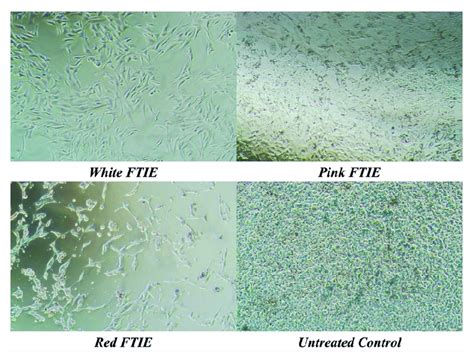 B16f10 Cell Density Was Observed Under Phase Contrast Microscopy After Download Scientific