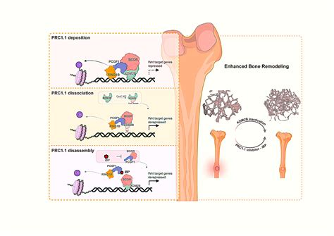 Researchers Identify A Prc1 1 Inhibitor For Treating Bone Deterioration Disorders Guangzhou