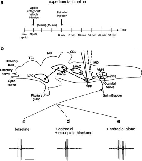 A Schematic Of The Experimental Timeline For Opioid Antagonist Infusion