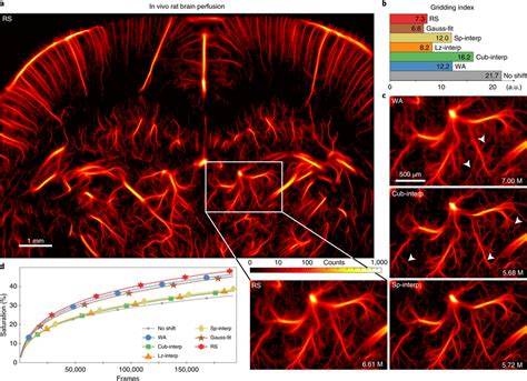 2d Ulm Density Based Renderings Of ‘in Vivo Rat Brain Perfusion With