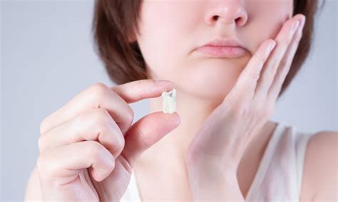 Wisdom Tooth Extractionremoval Dentists In Delhi