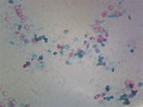 Saccharomyces Cerevisiae Budding Cells Wm Nebraska Scientific