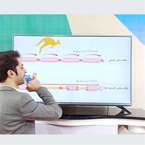 یاخته پشتیباننوروگلیا