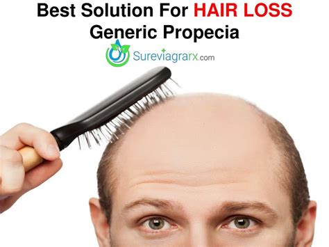 Ppt Best Solution For Hair Loss Generic Propecia Powerpoint
