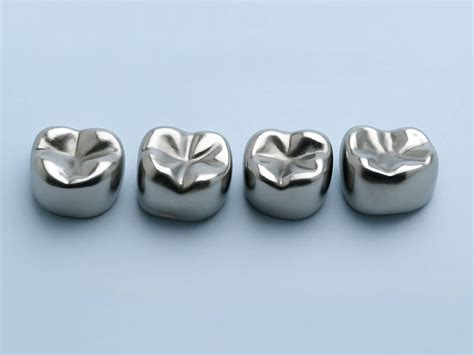What Are Hall Crowns And Their Benefits Eilertsen Dental Care