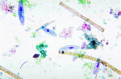 protista slide prepared slides