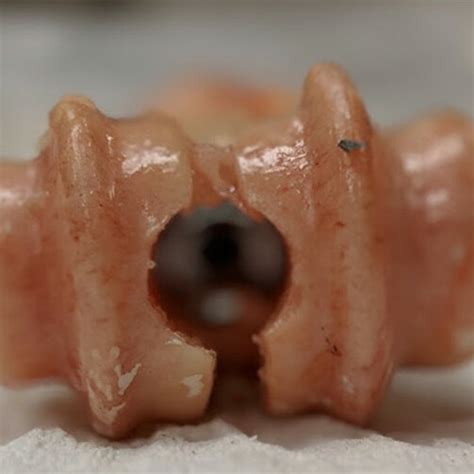 Distal Articular Surface Of Metatarsus Following Implantation Of The Download Scientific