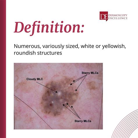 🫵 What Is The Diagnostic Dermoscopy Excellence