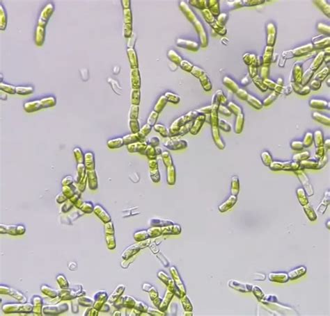 Class Xanthophyceae Yellow Green Algae Flashcards Quizlet