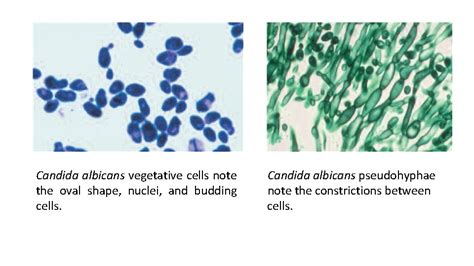 Practical Medical Mycology Lab 8 Yeast Identification Introduction