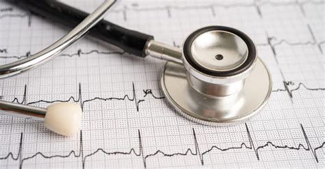 What Are Heart Arrhythmias The Common Good