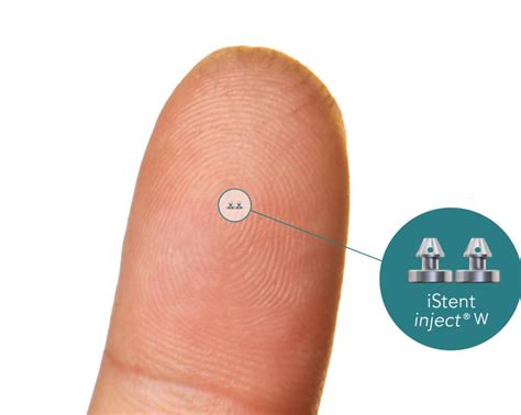 Insight Ophthalmic News On Linkedin How The Istent Inject Can Improve Outcomes In Patients With