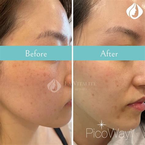 Picoway Before And After Everything You Need To Know About Picoway