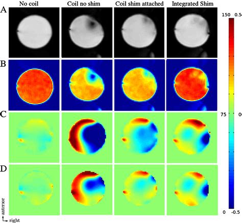 Figure 4 From Reducing Image Artefacts In Concurrent Tmsfmri By