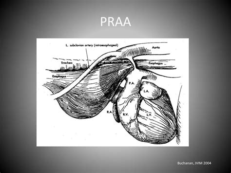 Ppt Persistent Right 4 Th Aortic Arch Powerpoint Presentation Free
