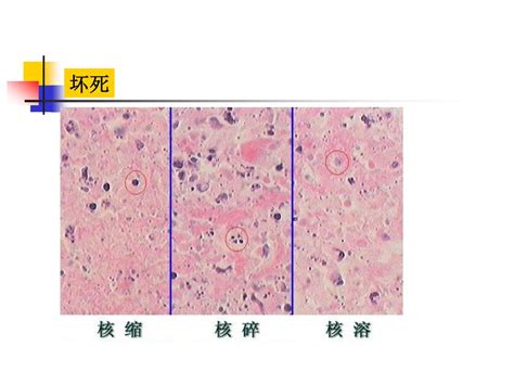 Ppt 第九章 细胞凋亡与疾病 Powerpoint Presentation Free Download Id3729727