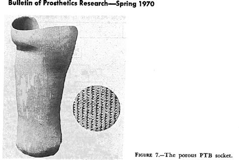 Figure 7 From Variants Of The Ptb Patellar Tendon Bearing Below Knee Prosthesis Semantic