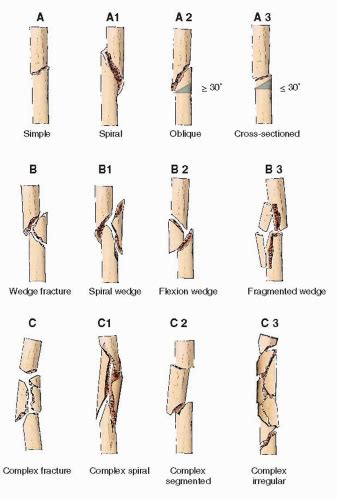 Winquist Classification And Hansen Classification Rxharun
